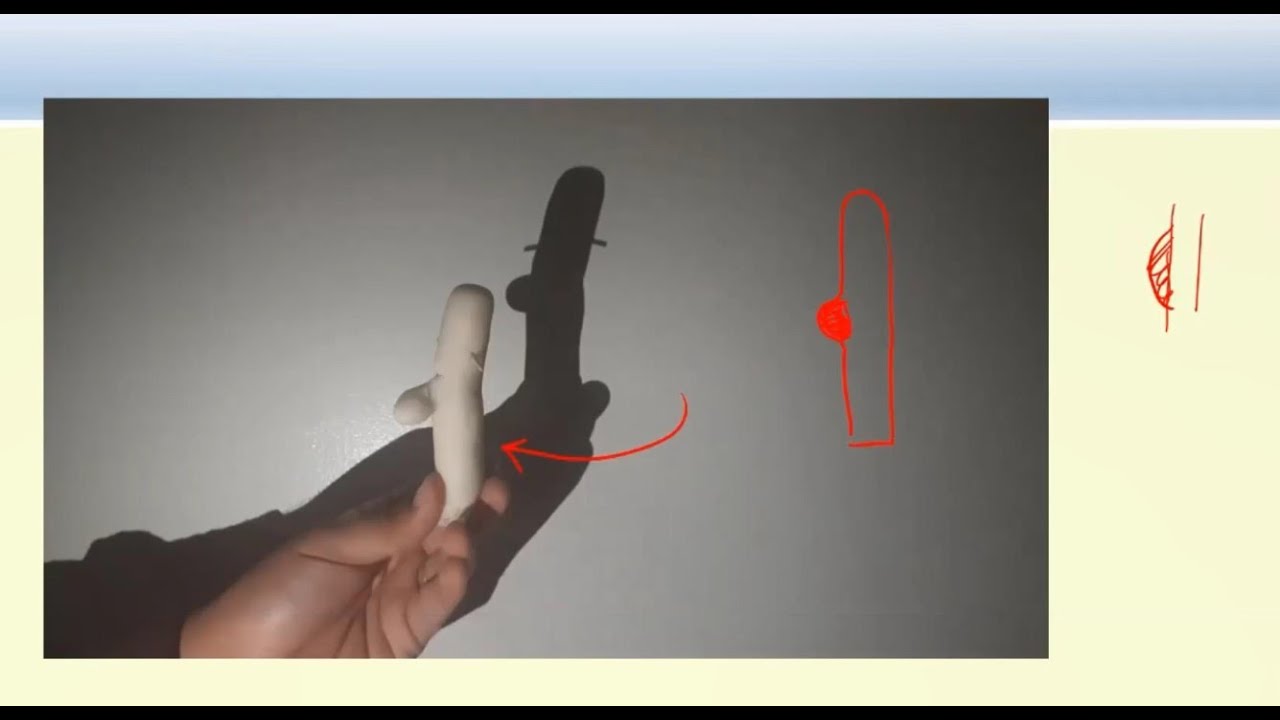Coronary angiography Shadow deception, Dr Alaa Nasr - YouTube