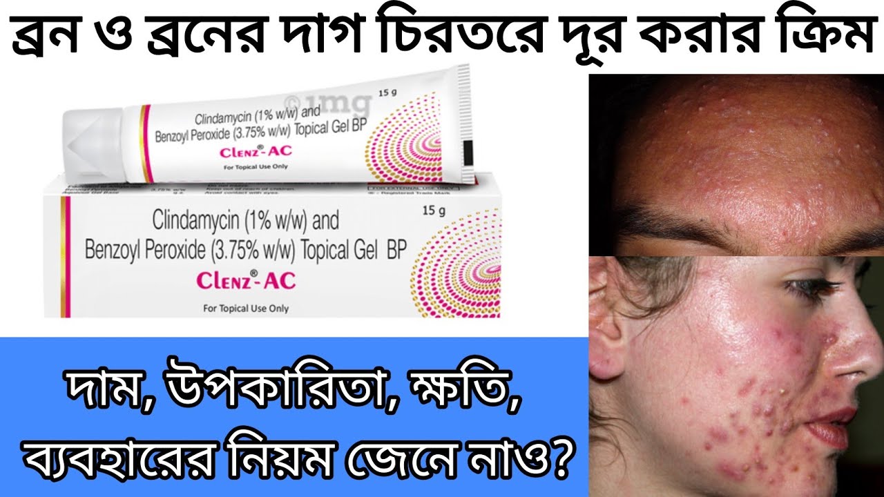 CLENZ-AC gel এর বাংলা রিভিও ? ডাক্তাদের পছন্দের সবথেকে সেরা ক্রিম // # ...