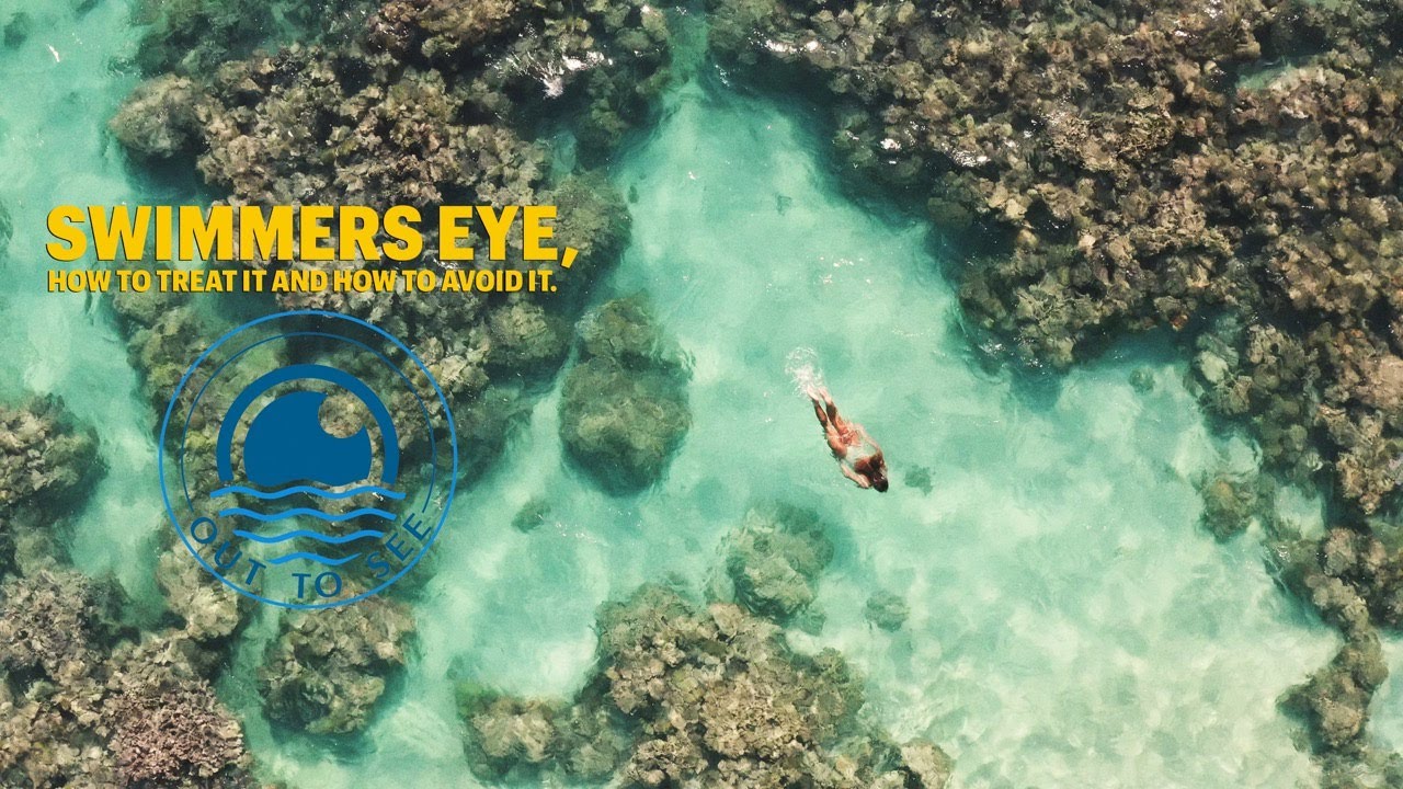Swimmers Eye, How to treat it & how to avoid it. - YouTube
