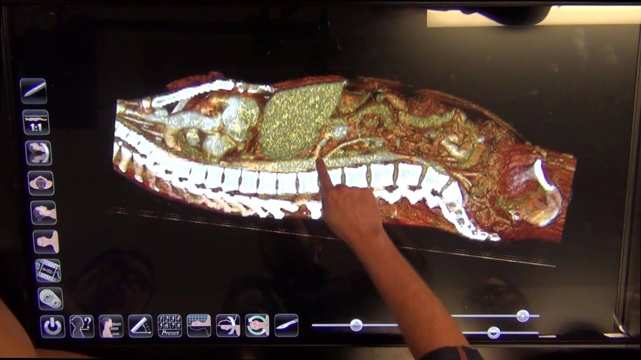 Anatomage Anatomy Review - YouTube