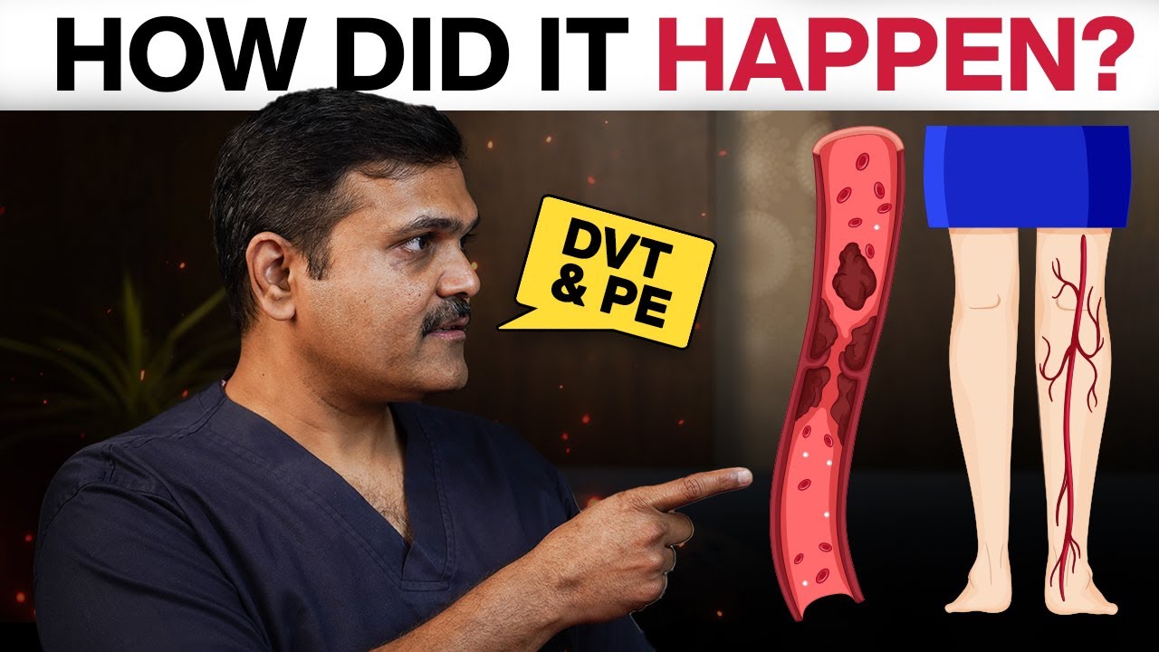 Don't Miss Out: How Leg Clots Can Cause Lung Troubles! DVT & PE ...