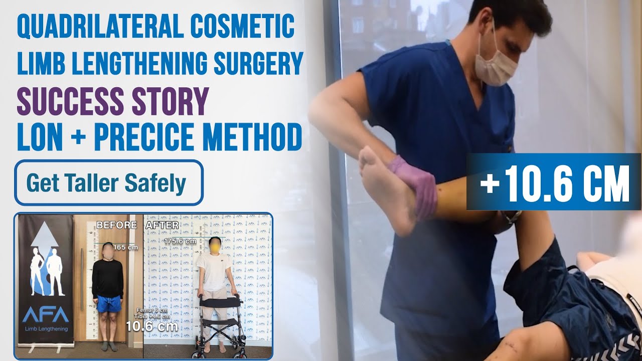 Limb Lengthening Success Story Success Story - Quadrilateral Precice 2 ...