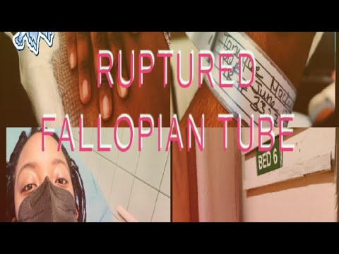 MY EMERGENCY SURGERY|| RUPTURED FALLOPIAN TUBE🥺 ECTOPIC PREGNANCY 🥀 ...