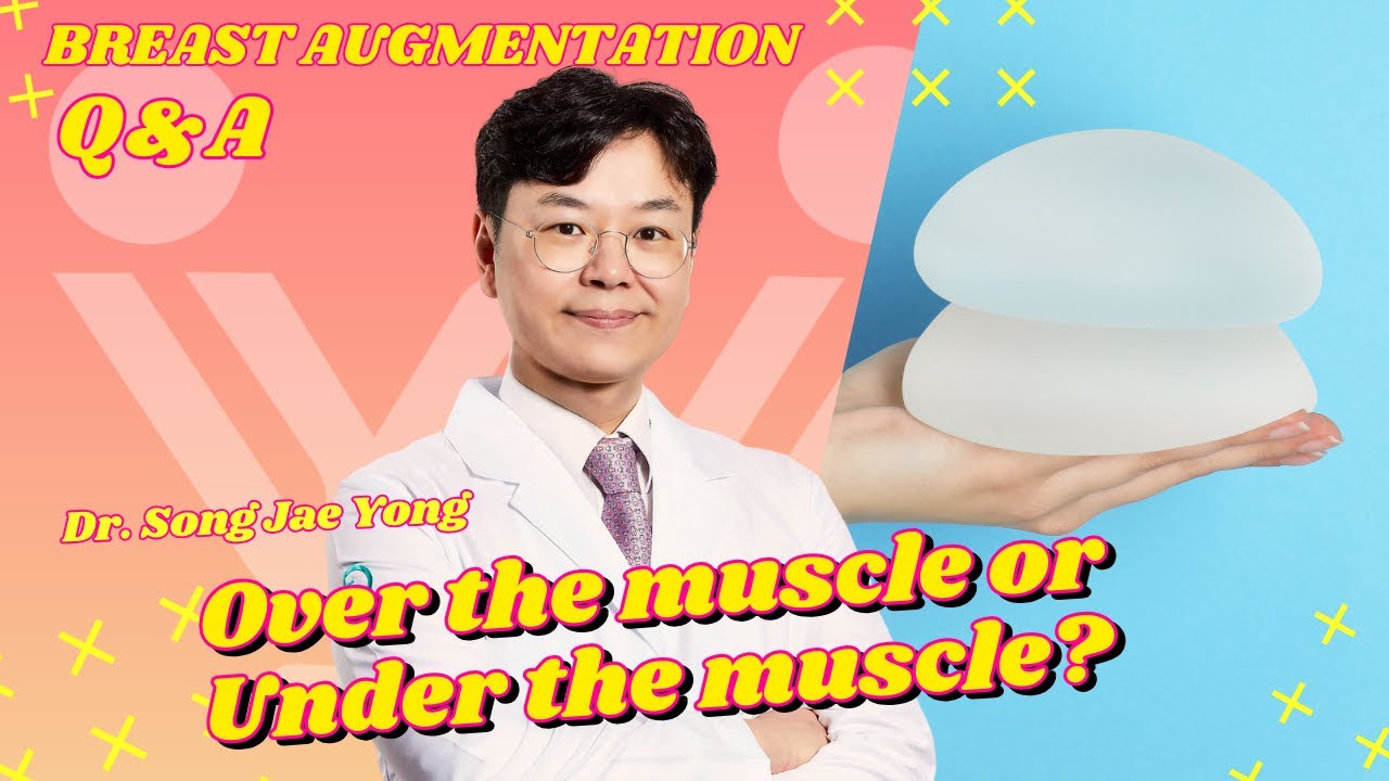 Under the muscle or over the muscle?| Breast augmentation Q&A | Dr Song ...