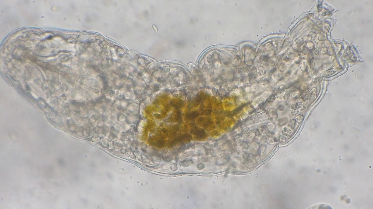 TARDIGRADO - YouTube