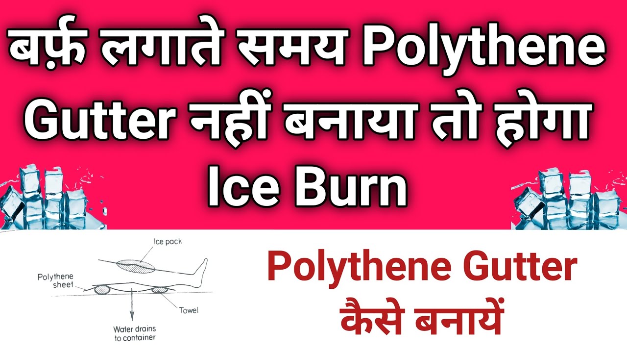 Positioning of Ice Pack and Polythene Gutter | Cold therapy | ice pack ...