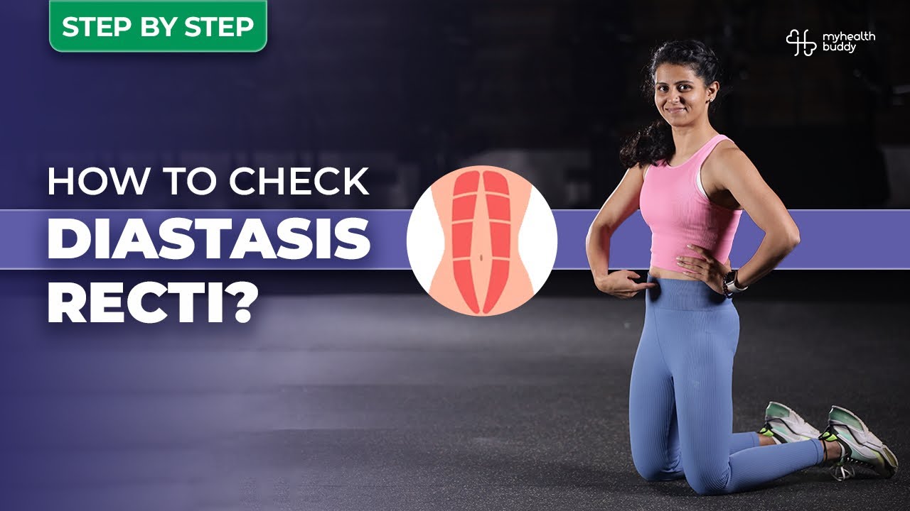 How to check Diastasis Recti at home? - YouTube