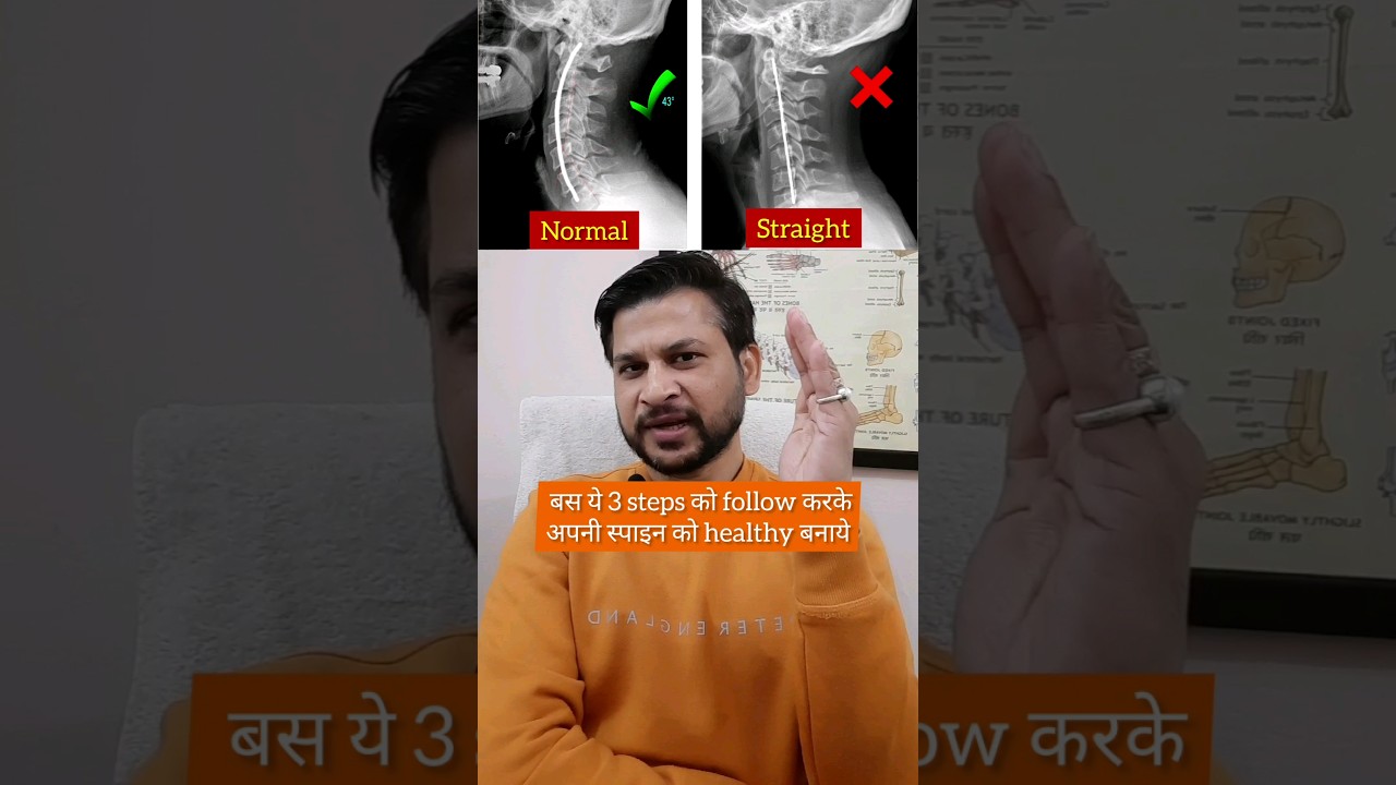 How to correct Straightening of Cervical Spine(Fix loss of Cervical ...