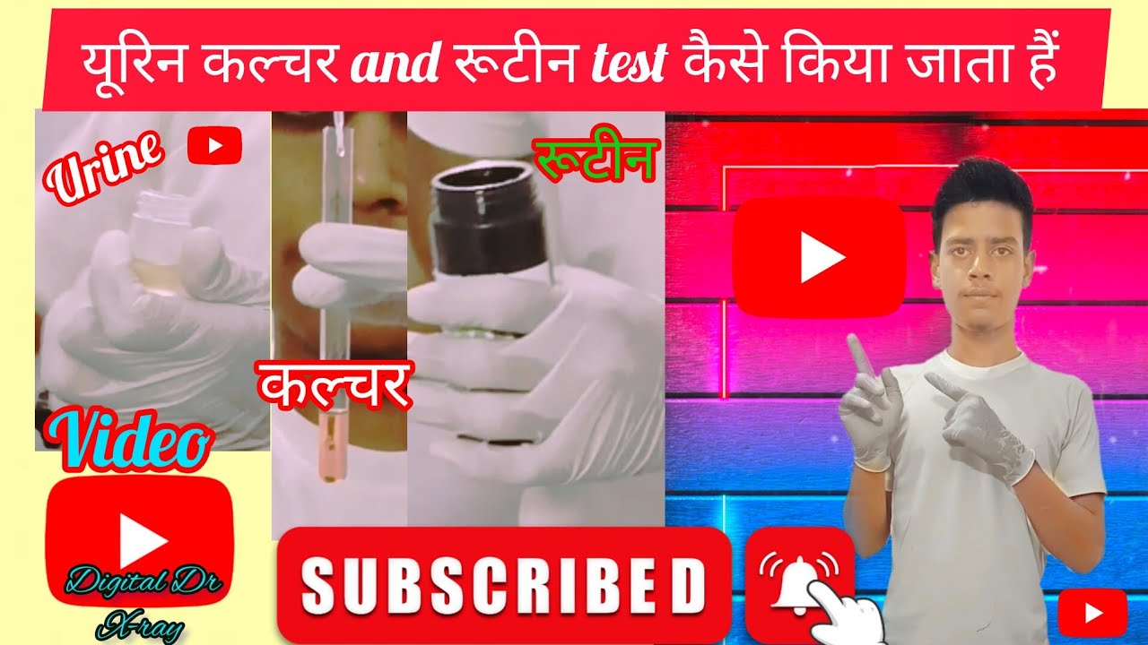 urine culture And routine test report 🧪video #_lab_technician #_DMLT ...