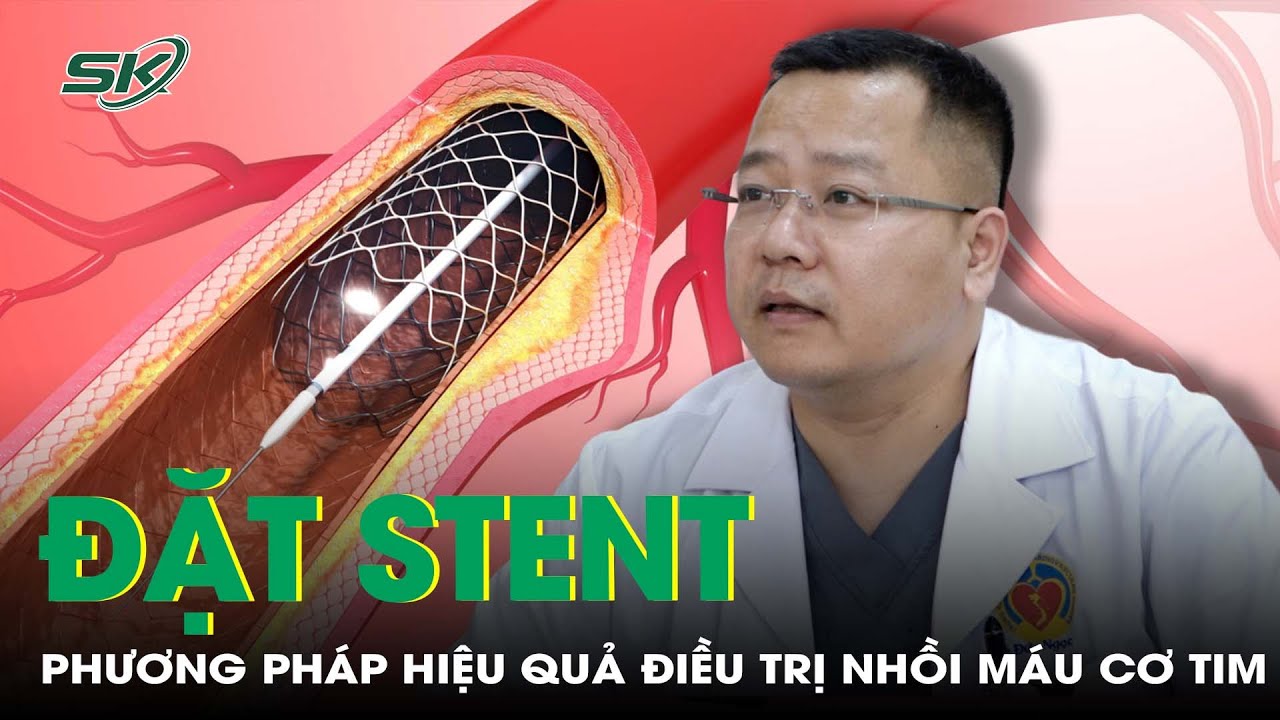 Đặt stent: phương pháp hiệu quả điều trị nhồi máu cơ tim | SKĐS - YouTube