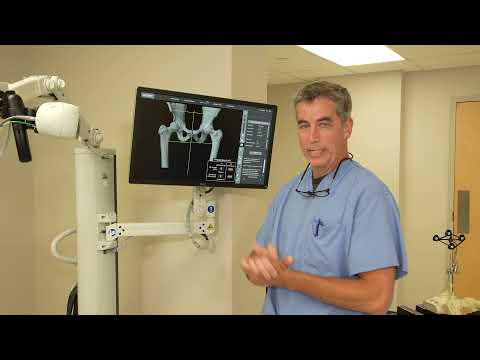 Total Hip Replacement Utilizing Mako Robot with Dr. Mark Cutright
