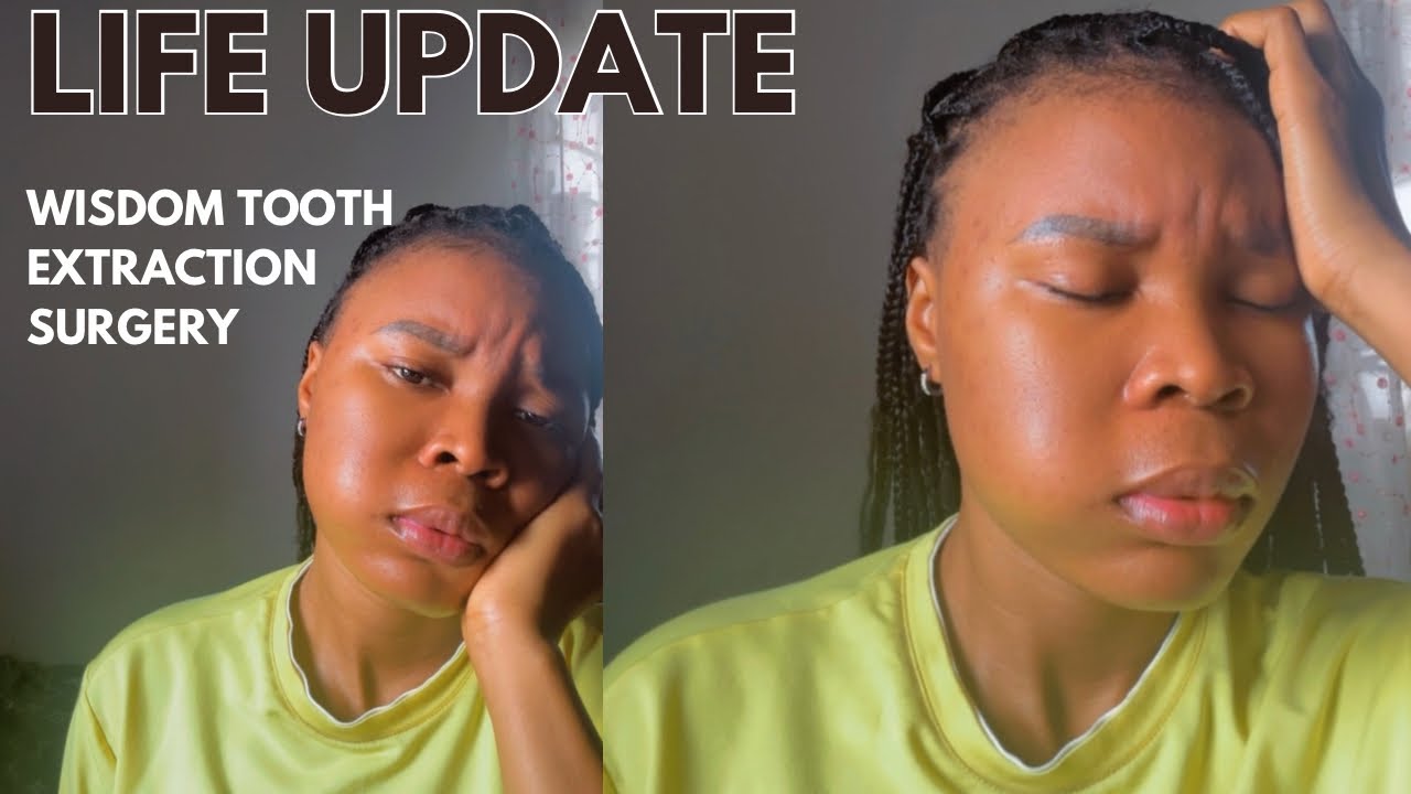 HAD A SURGICAL WISDOM TOOTH EXTRACTION IN NIGERIA || WORST EXPERIENCE ...