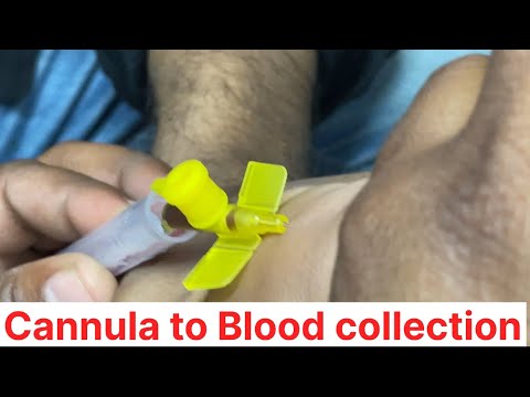 Blood 🩸 collection for Cannula | खून (ब्लड) निकालना सीखे | how to blood ...