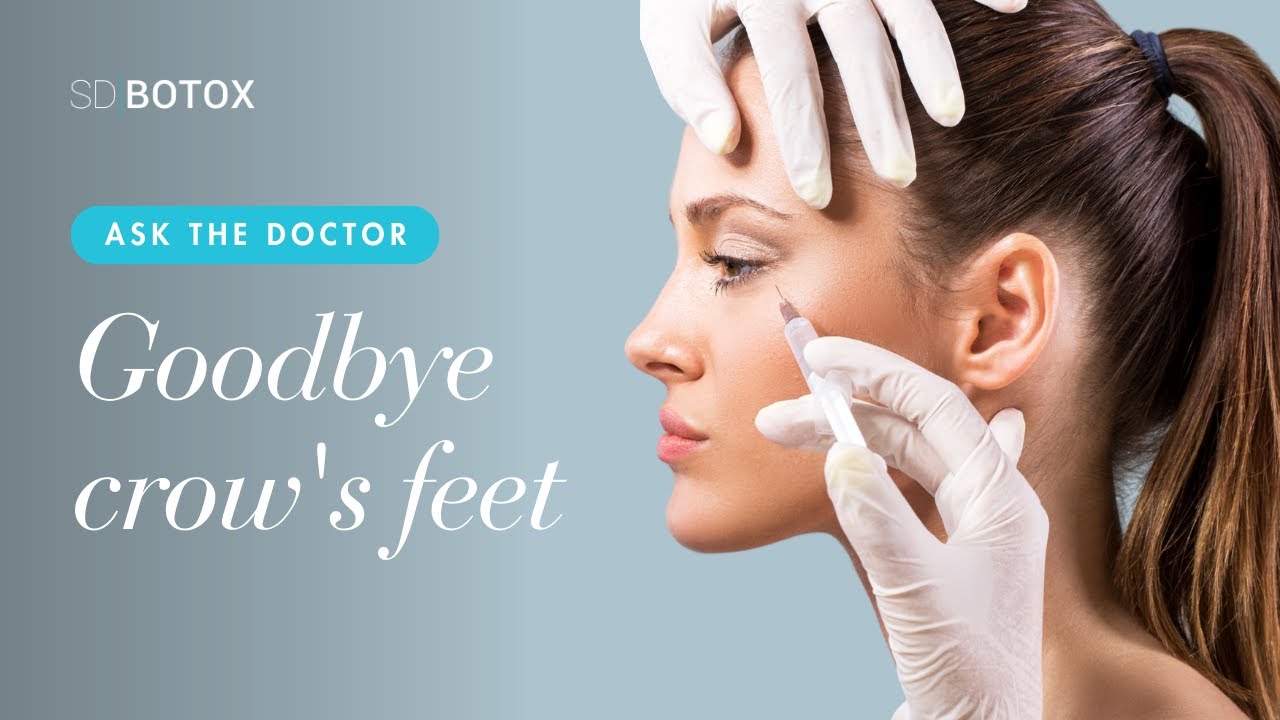 Targeting Crow's Feet Effectively with Botox - YouTube