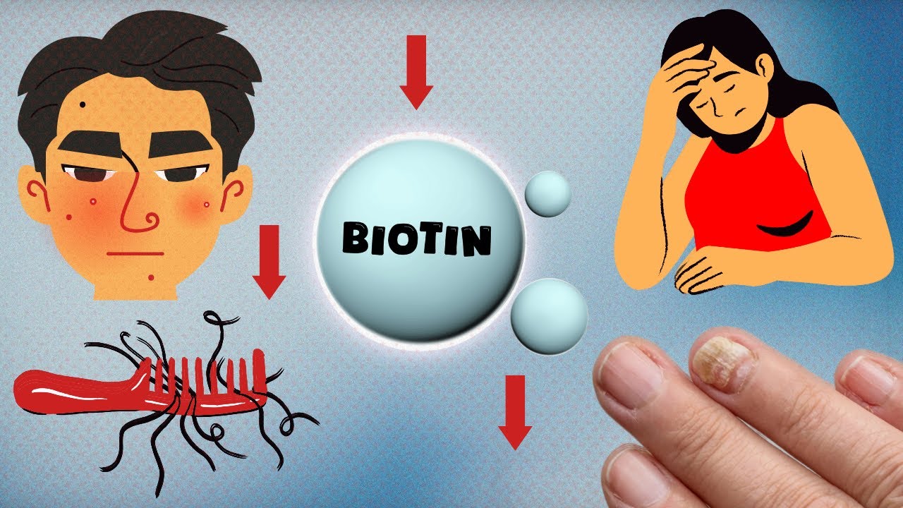 4 Signs that You have Biotin Deficiency - YouTube