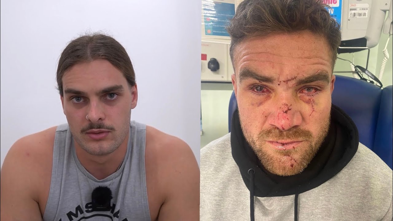 FUTURE SELF S3 E BONUS - Life after being blinded W/ Mathew Syron - YouTube