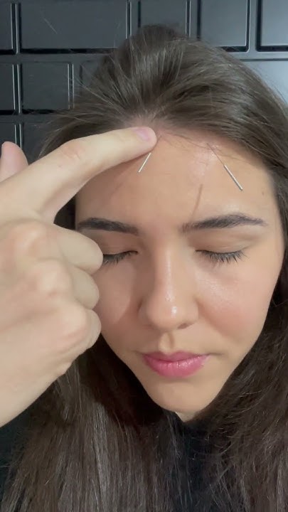 Dica de ponto de Acupuntura - Melhora o Discernimento - YouTube