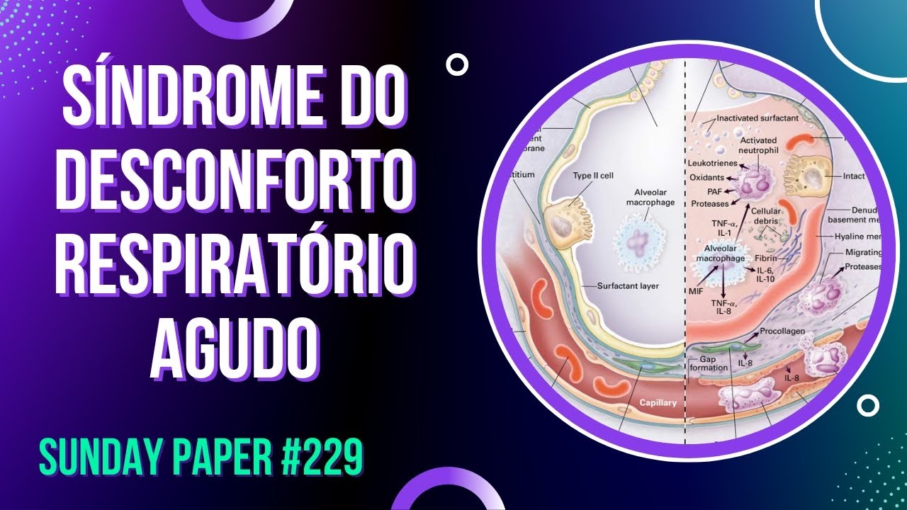 Síndrome do Desconforto Respiratório Agudo (SDRA SARA) #229 - SUNDAY ...