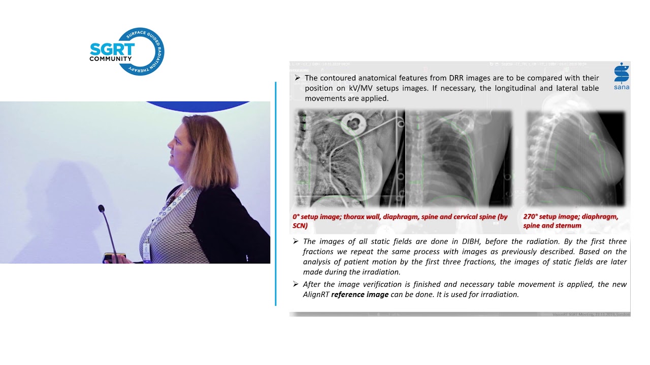 Implementation of AlignRT System for Marker less Patient Positioning ...
