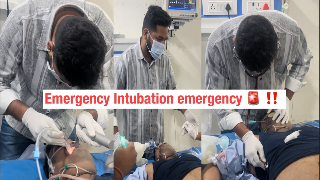 How to Intubate? | Intubation Procedure & Technique | Emergency ...