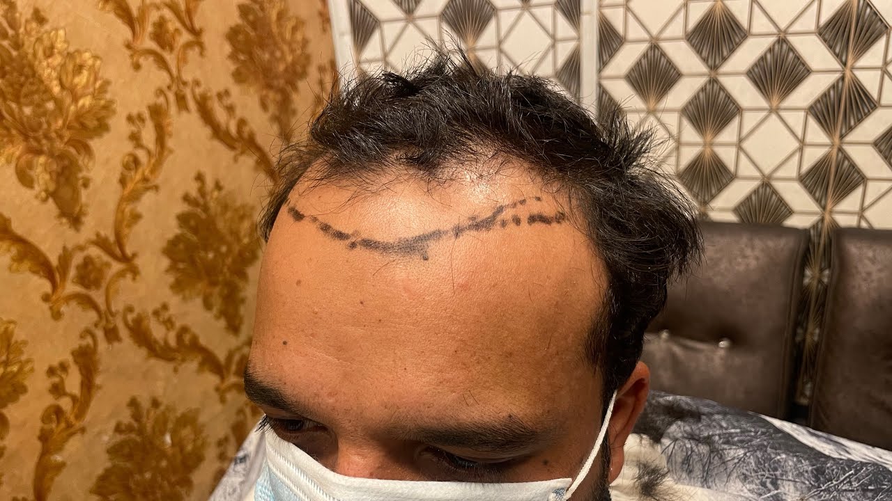 Patch Unit Hair Style Vig Hair Style Qadri Salon Pattoki - YouTube