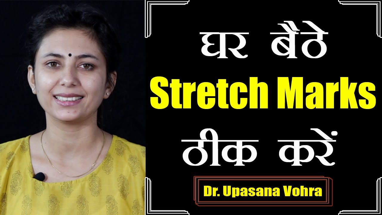 Ghar Baithe Stretch Marks Door kare | Upasana Vohra | Dr Upasana Vohra ...