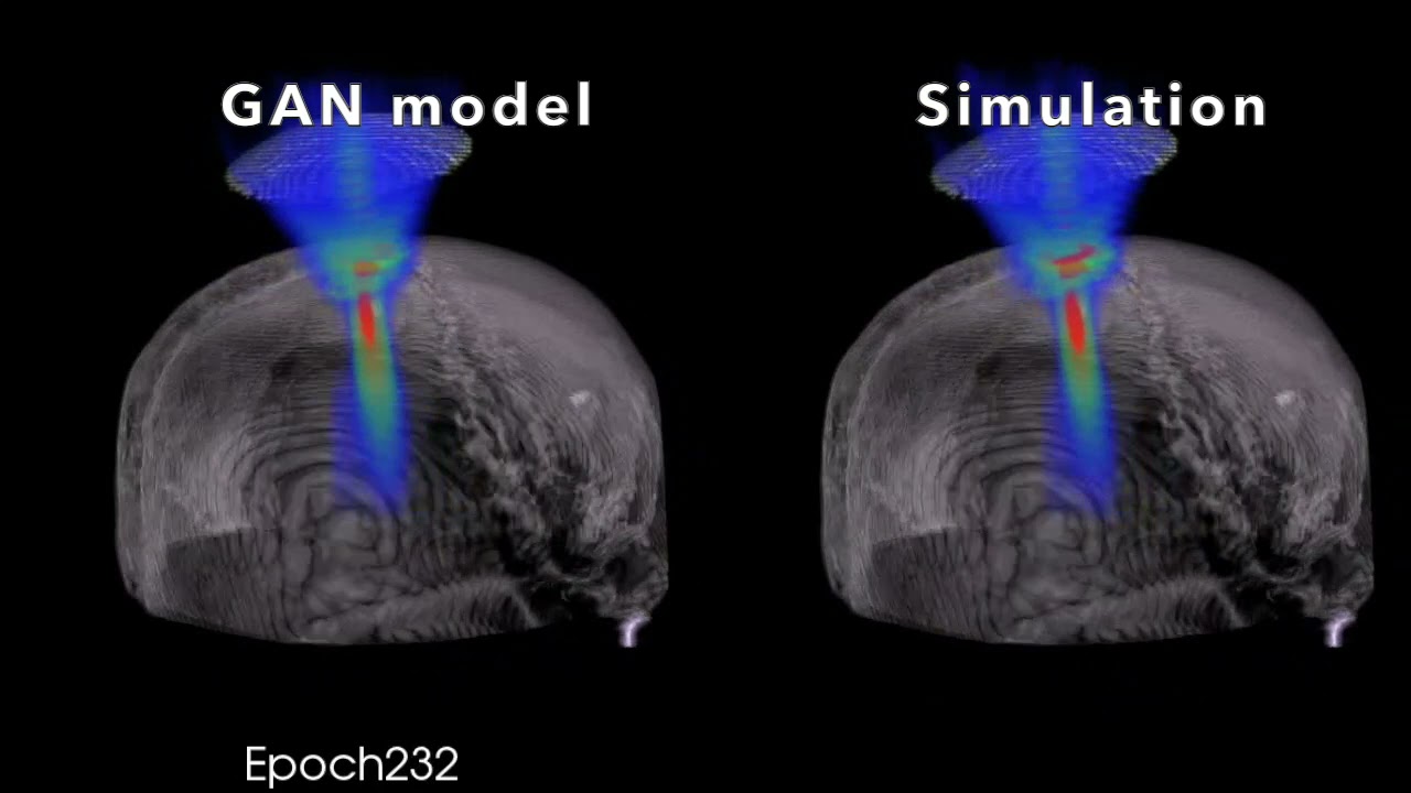 Neural network can learn ultrasound wave propagation - YouTube