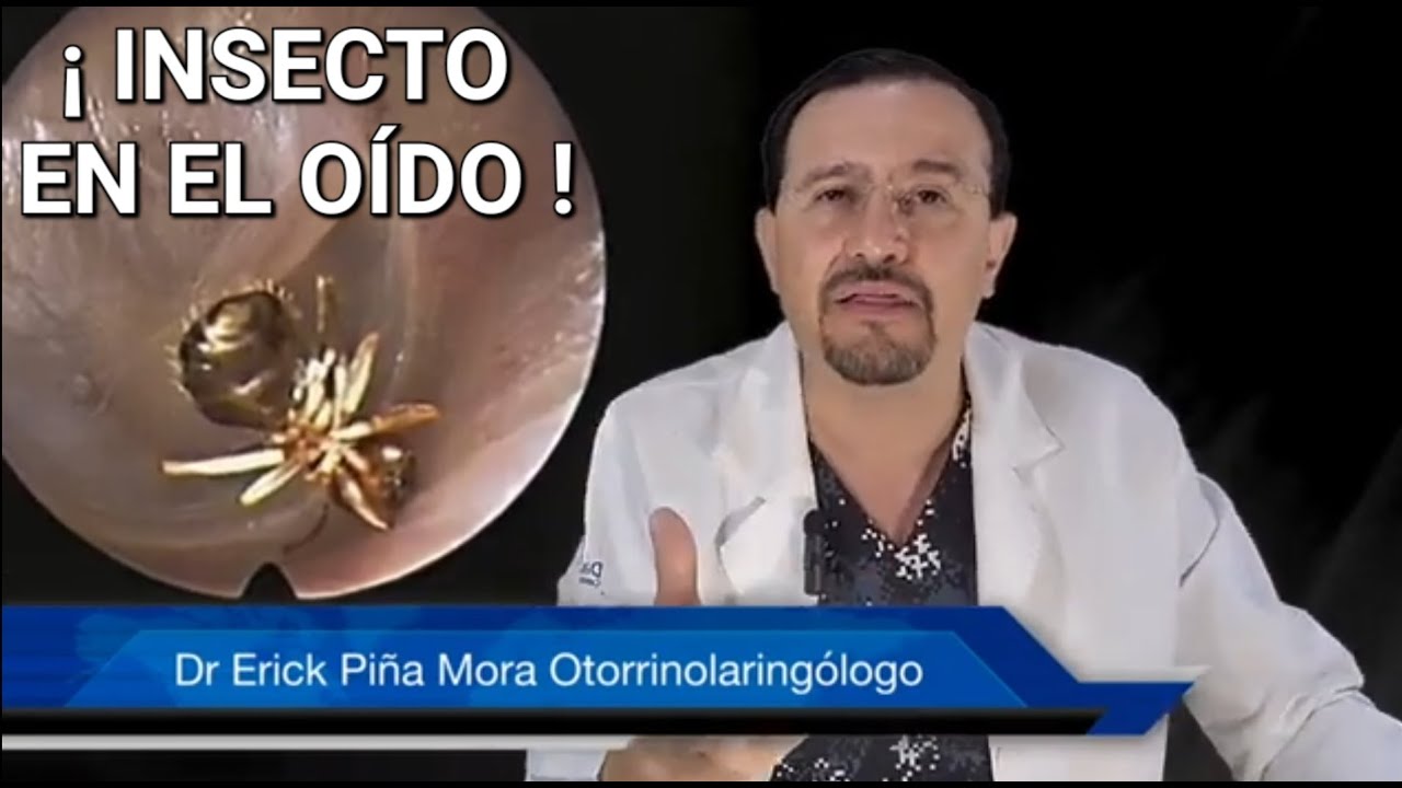¿QUÉ HACER SI SE TE METE UN INSECTO EN EL OIDO? - YouTube