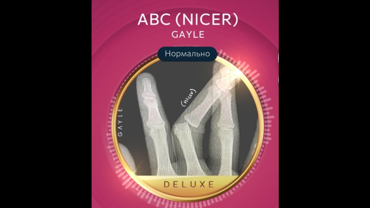 Beatstar | GAYLE - ABC ( NICER ) [ DELUXE - Normal ] ( new record ...