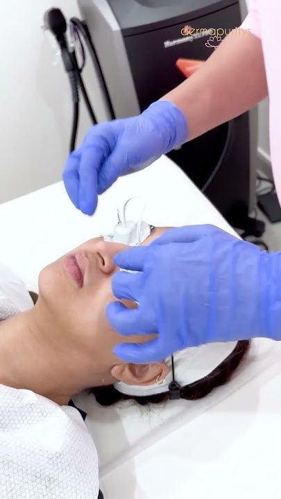 Derma Puritys | 4D ClearLift Treatment - YouTube