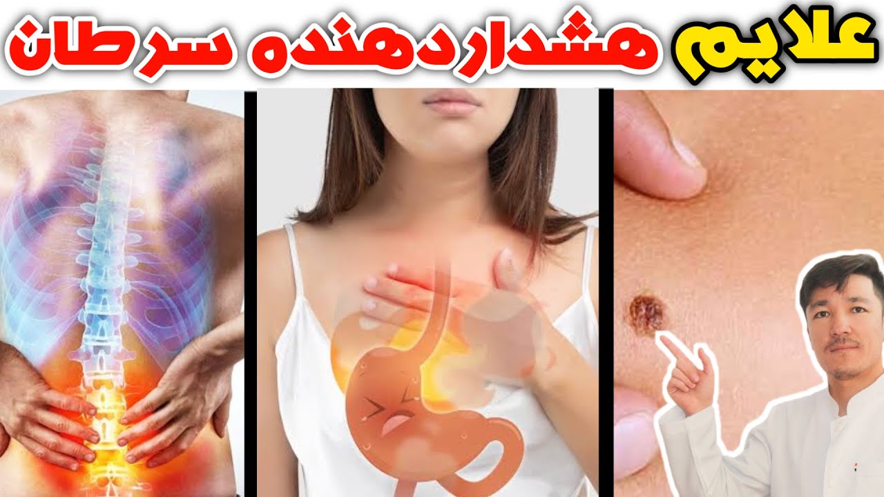 ۱۰ علامت هشداردهنده سرطان که نباید نادیده بگیرید کمر دردی، یبوست