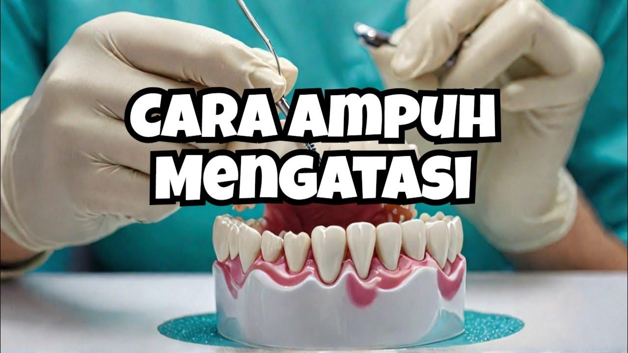 mengobati sakit gigi paling ampuh - YouTube