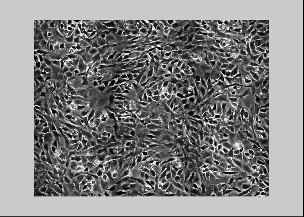 Chondrocytes in Live Cell Imaging Chamber - YouTube