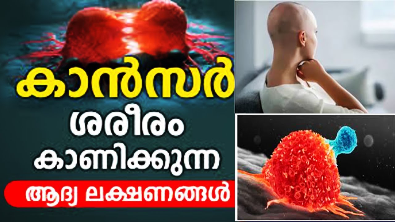 കാൻസർ അപകടകാരിയാണോ | cancer | doctor interview - YouTube