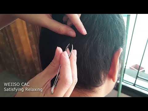 Satisfying Relaxing Cabut Uban Adik #1 - YouTube