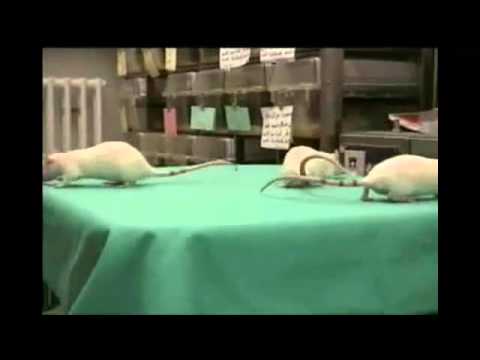 Stiff person syndrome 1/3