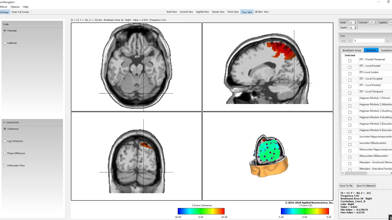 NeuroNavigator New Navigation Controls - YouTube