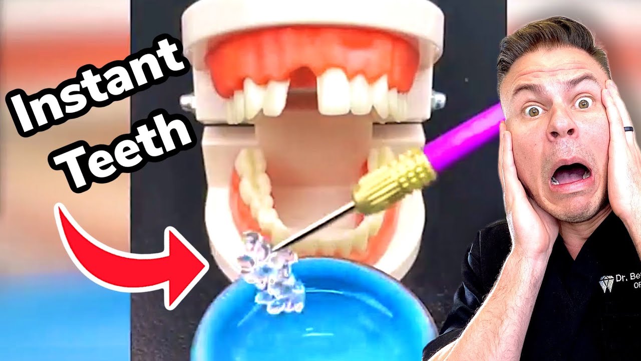 Instant Fake Teeth In SECONDS?! Orthodontist Reacts! - YouTube
