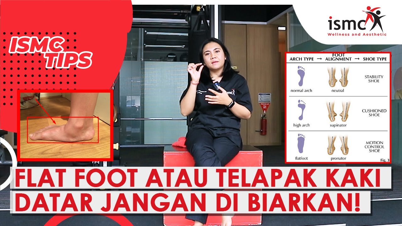 CARA PENANGANAN DAN PEREGANGAN UNTUK FLAT FOOT ATAU TELAPAK KAKI DATAR ...