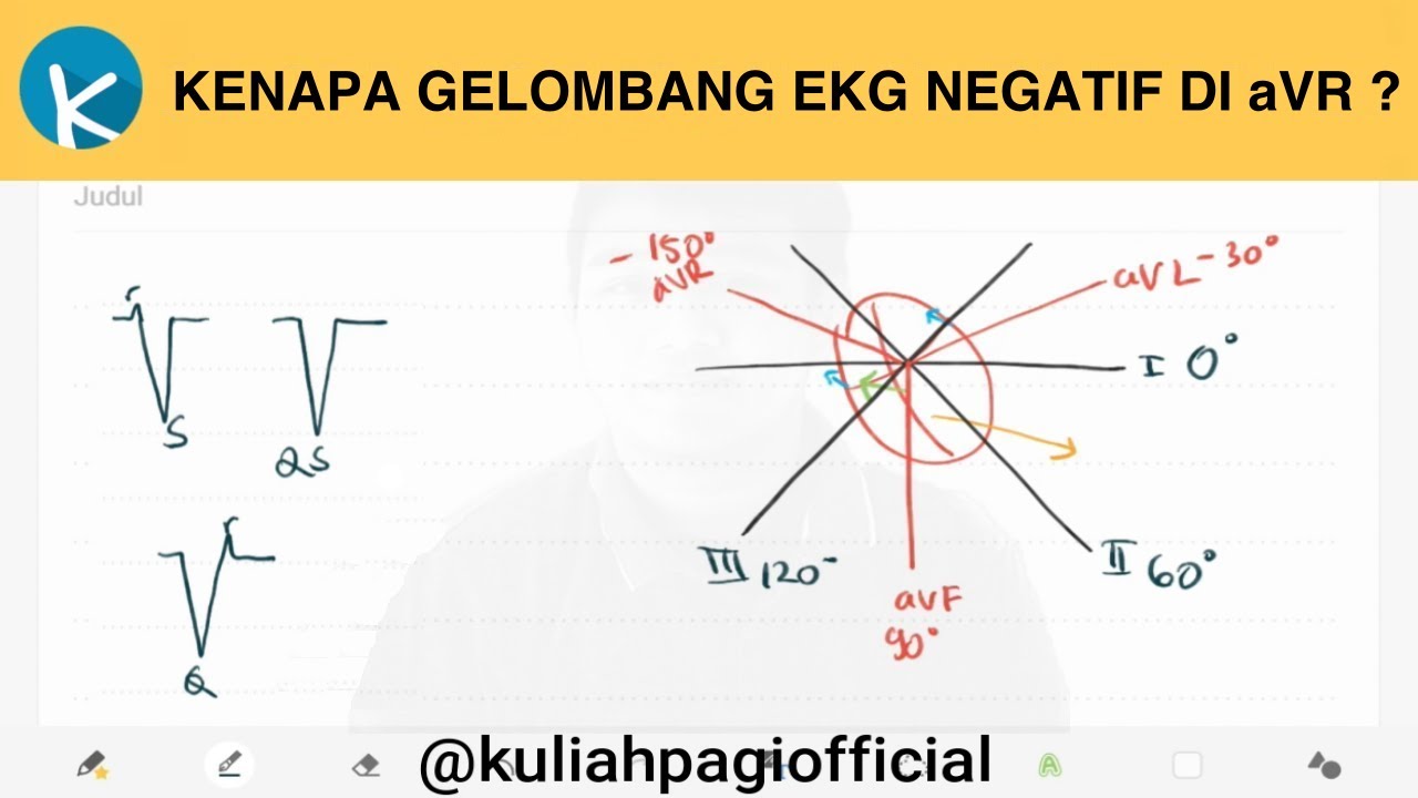 Sadapan EKG aVR - EKG Dasar (15/20) - YouTube