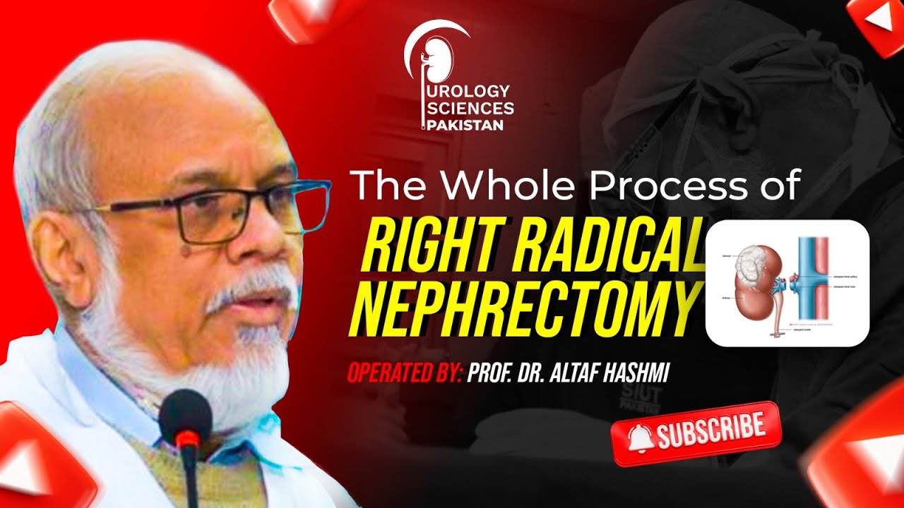 Right Radical Nephrectomy By Prof Altaf Hashmi II Surgerytechnique right-radical-nephrectomy-by-prof-altaf-hashmi-ii-surgerytechnique