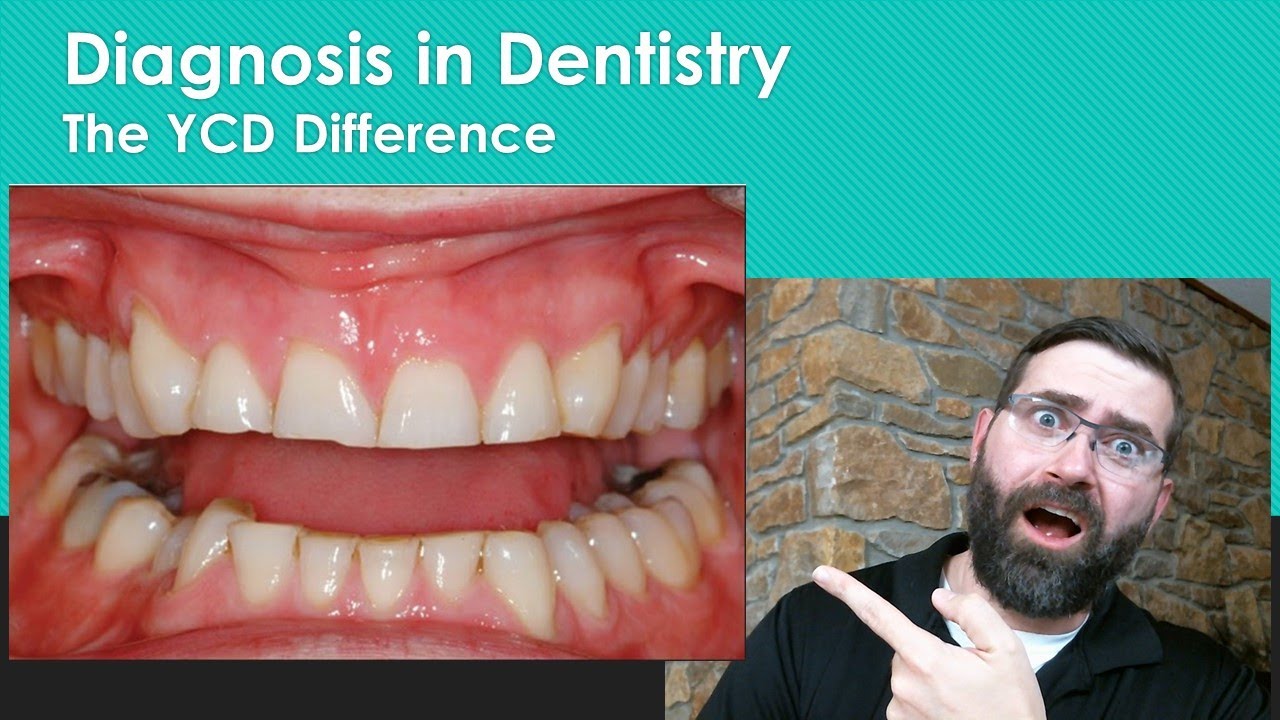 Diagnosis in Dentistry: The YCD Difference - YouTube