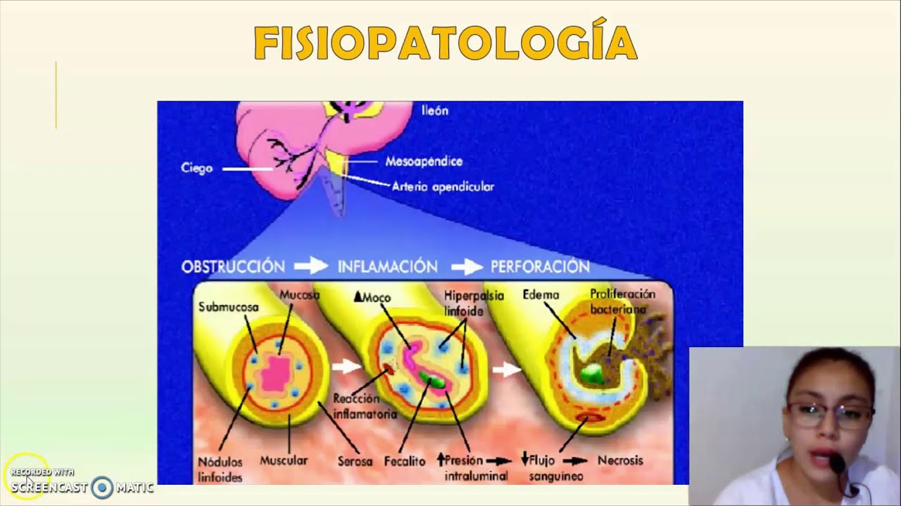 Plastrón Apendicular - YouTube