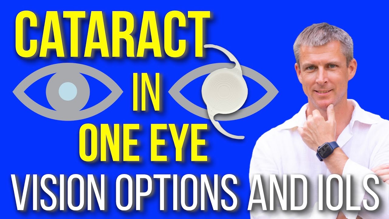 IOL for cataract in one eye only - YouTube