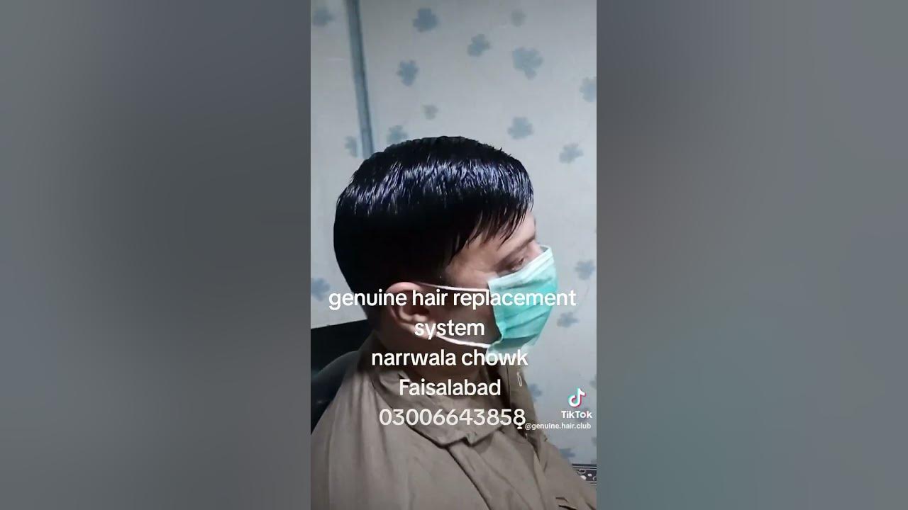 Hair replacement system - YouTube