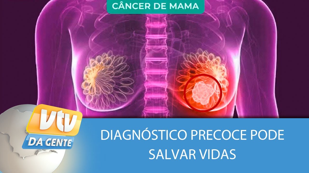 Como Descobrir Um Câncer De Mama Precocemente – NHMRJ