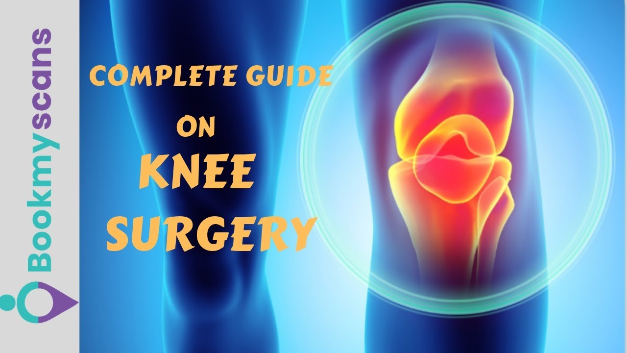 A complete Step by Step guide on Knee Replacement Surgery | BookMyScans ...