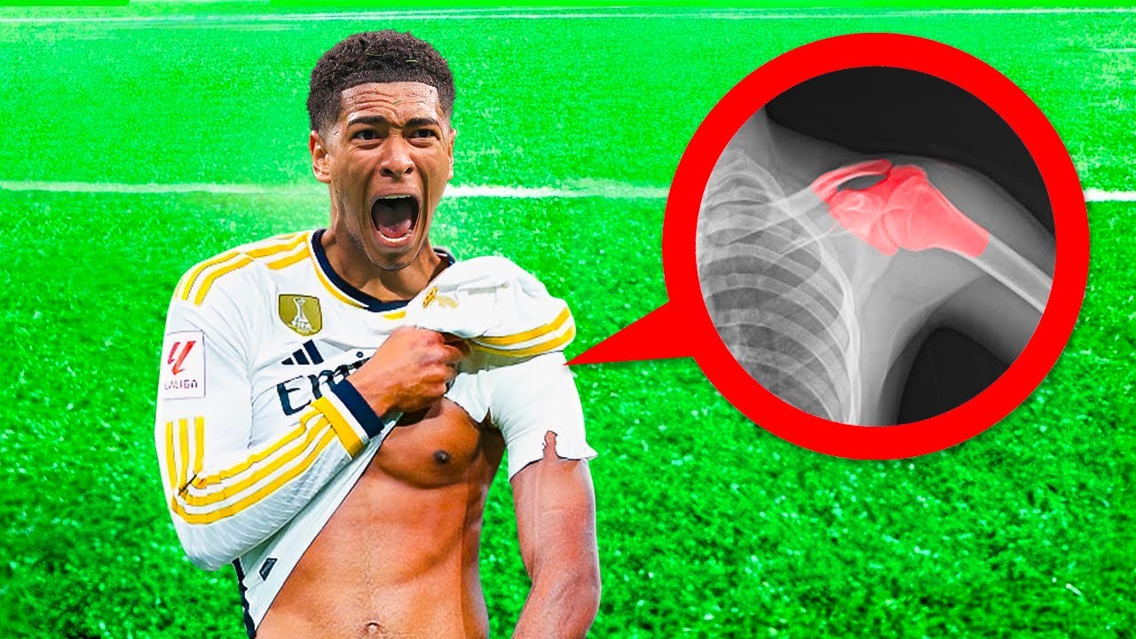 10 Times Footballers Played The Game WITH INJURIES - YouTube