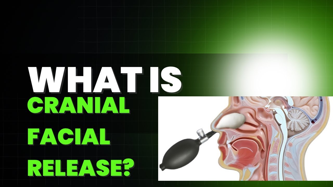 What is cranial facial release? - YouTube