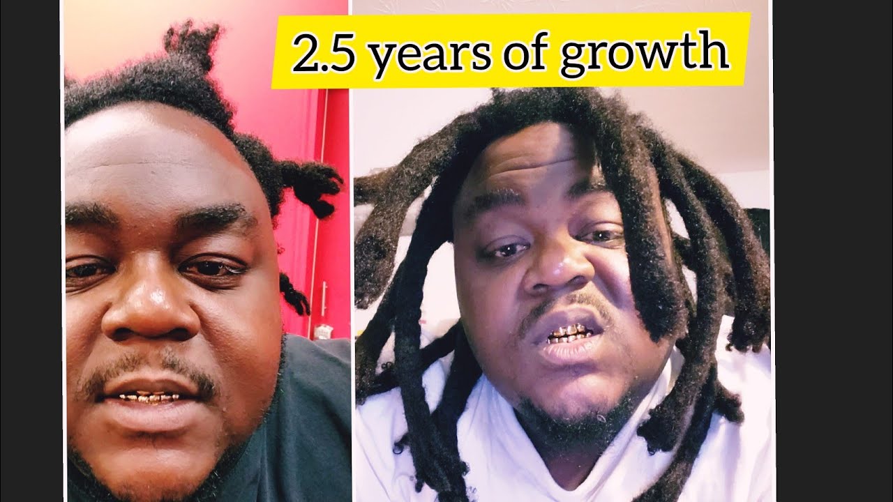 #fastgrowth The best dreads wicks freeform thick locs journey from ...